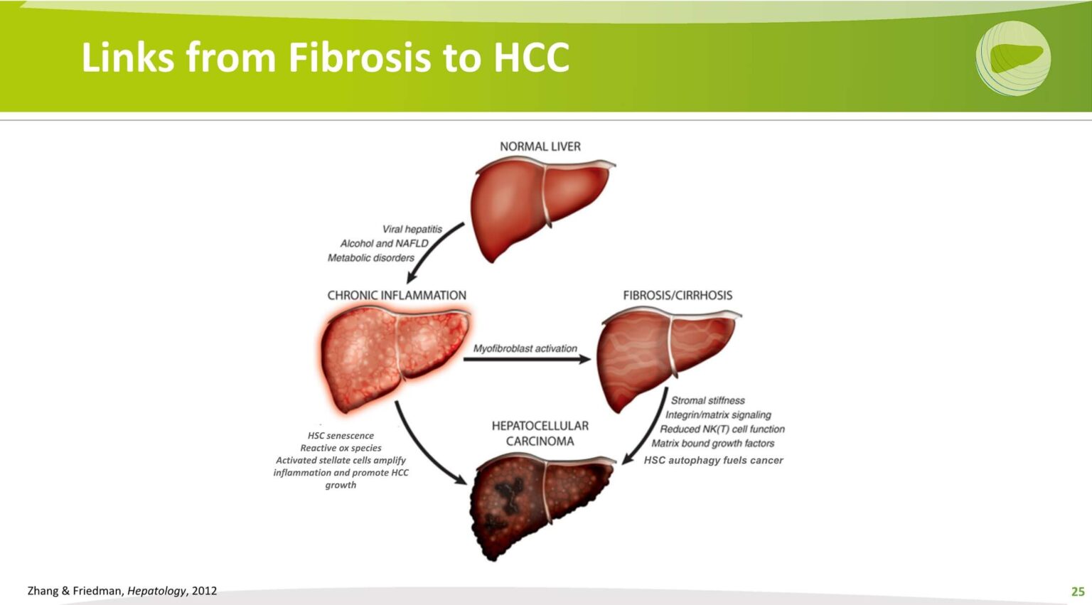 HCC Pathogenesis In NASH And The Impact Of Fibrosis - PanNASH